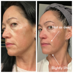 Review: Evenskyn® Lumo Facial Device – Never Idle Life
